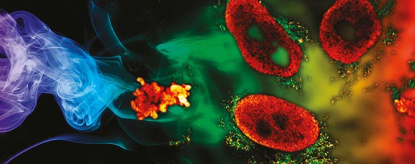 Lasers in fluorescence microscopy - @abberior.rocks