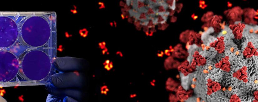 Where the tiny becomes mighty: light vs electron microscopy - @abberior ...