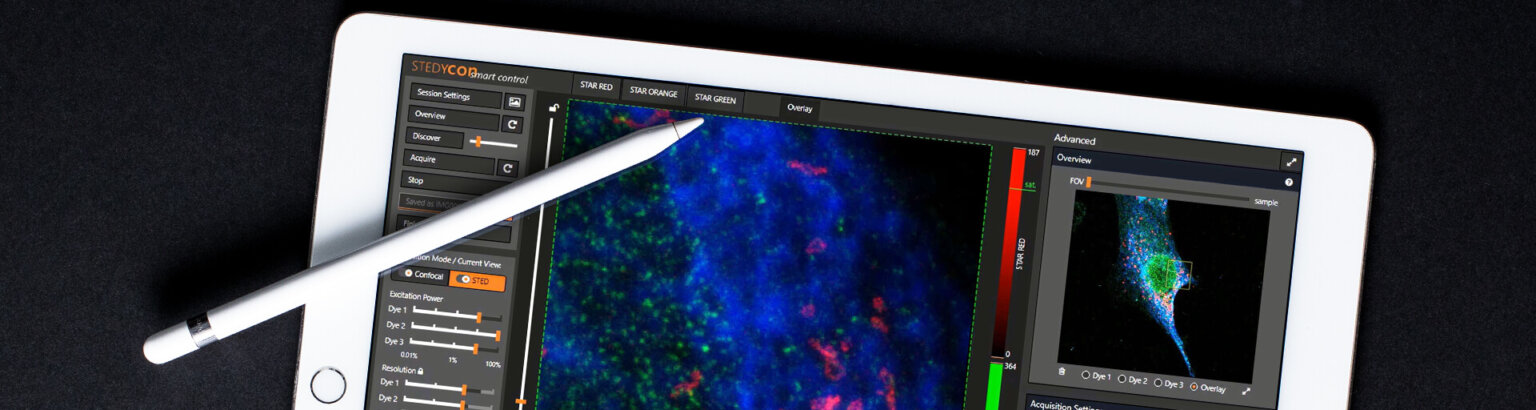 STEDYCON - @abberior.rocks