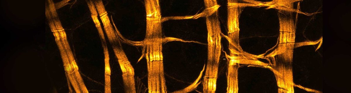 Phalloidin labeling protocol for optimal F-actin staining
