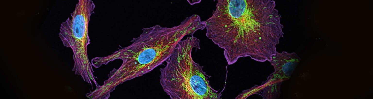 NHS ester protocol for labeling proteins
