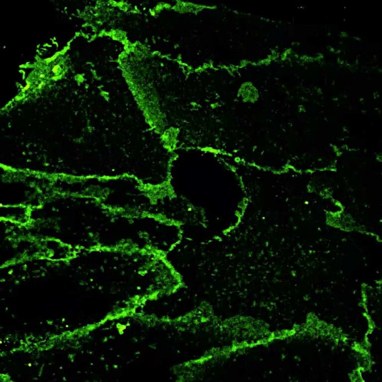 abberior STAR - @abberior.rocks