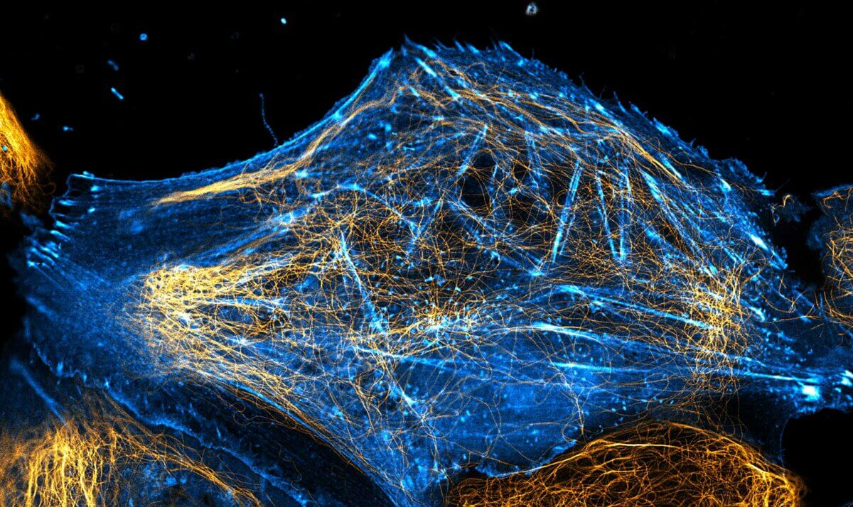Live Cell Imaging @abberior.rocks