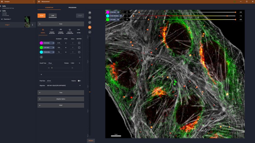 LiGHTBOX software @abberior.rocks