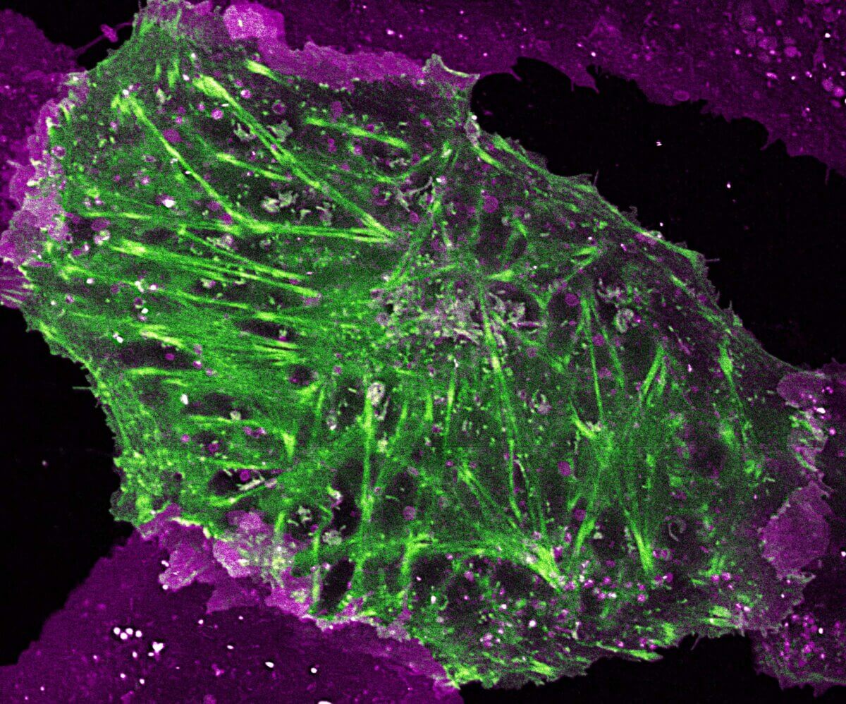 abberior LIVE - @abberior.rocks