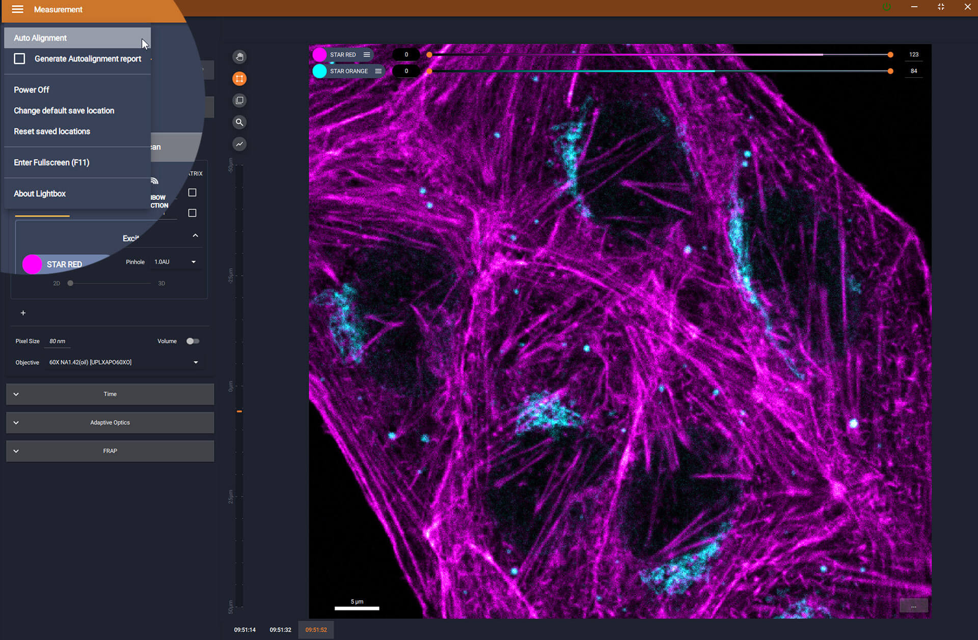 LiGHTBOX software @abberior.rocks