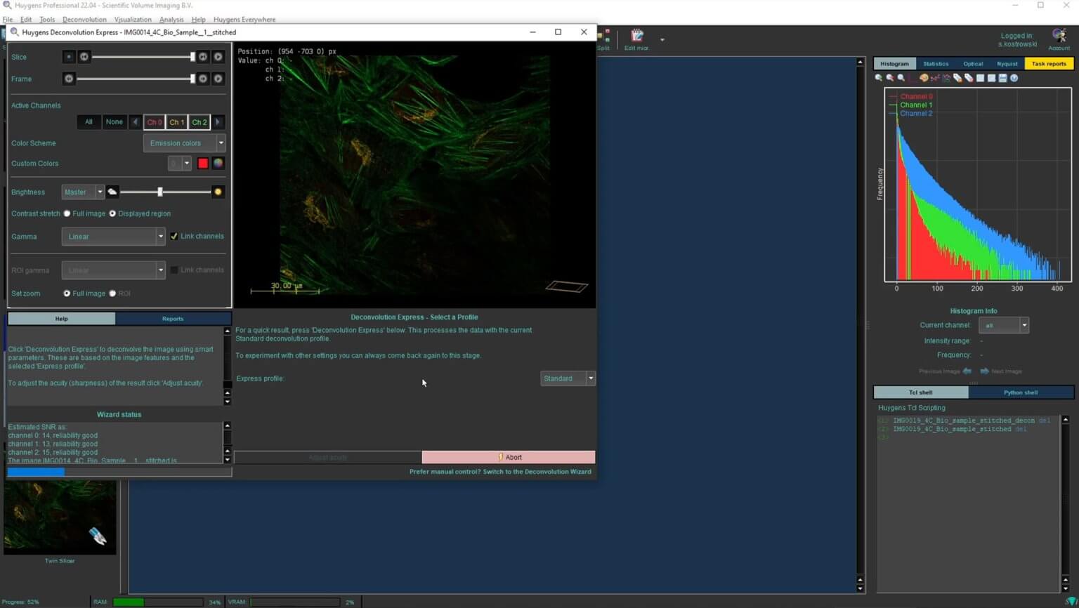 STEDYCON smart control software @abberior.rocks