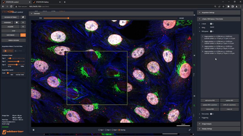 STEDYCON smart control software @abberior.rocks