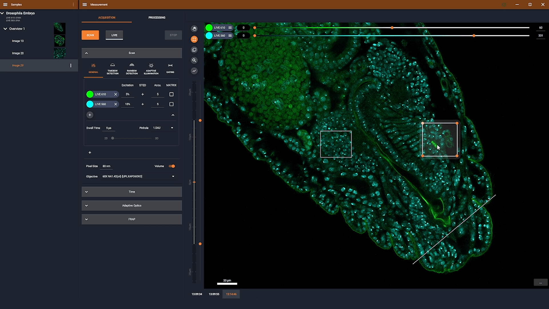 LiGHTBOX software @abberior.rocks
