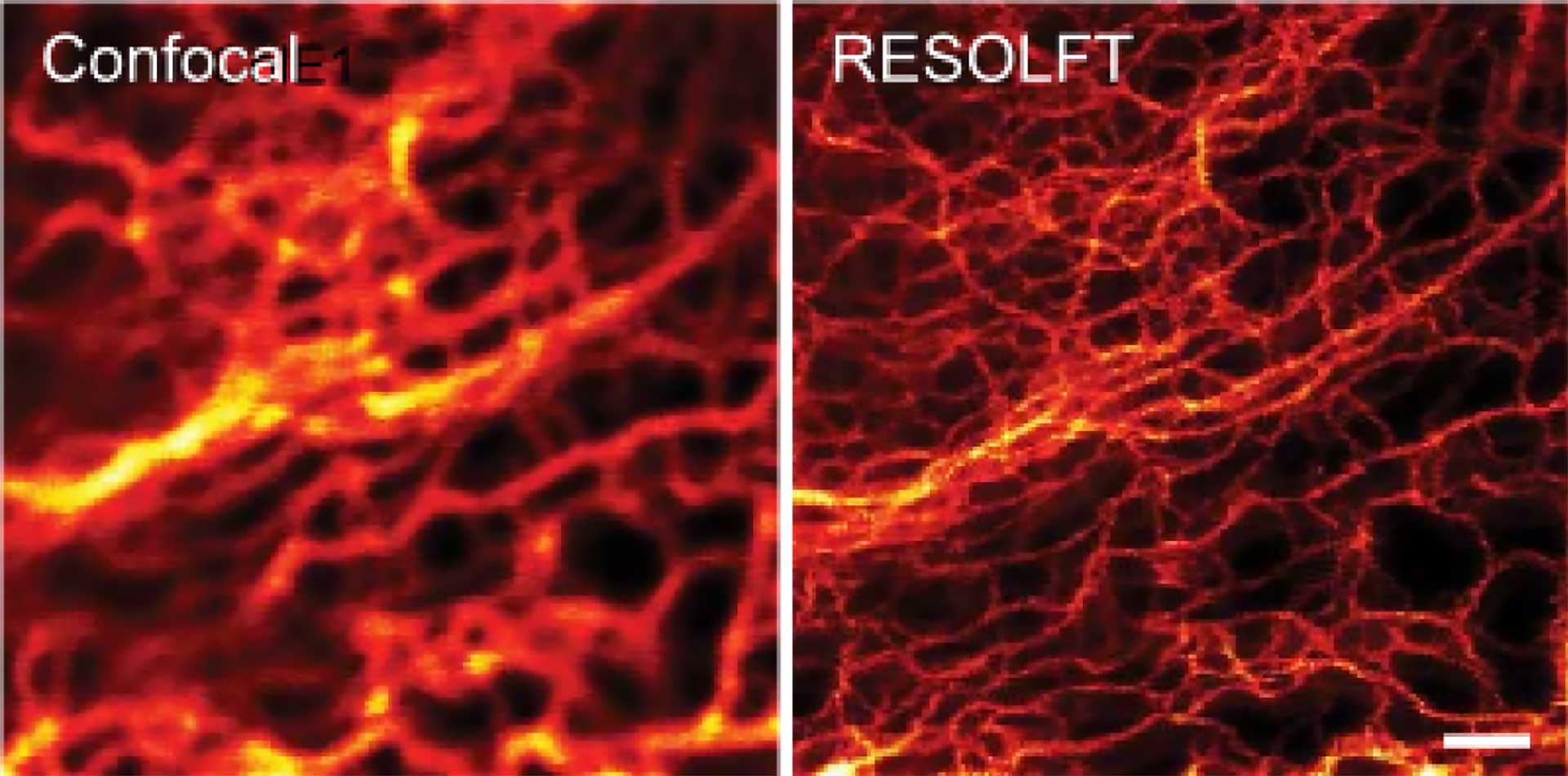 Microscopy Tutorials - @abberior.rocks