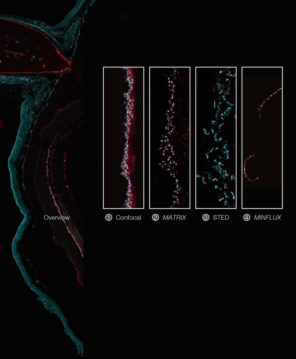 MIRAVA POLYSCOPE @abberior.rocks
