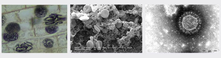 Where the tiny becomes mighty: light vs electron microscopy - @abberior ...