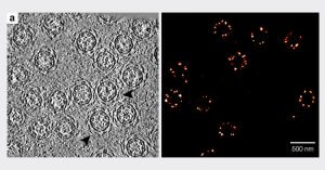 Where the tiny becomes mighty: light vs electron microscopy - @abberior ...
