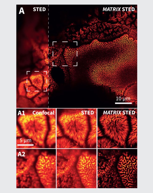 MATRIX STED – many eyes see more than one