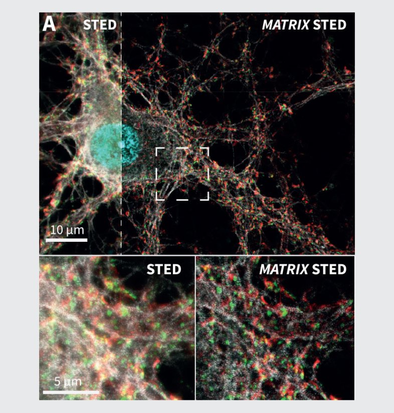 MATRIX STED – many eyes see more than one