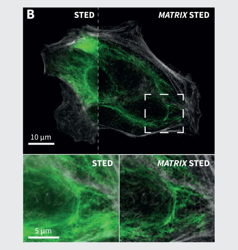 MATRIX STED – many eyes see more than one