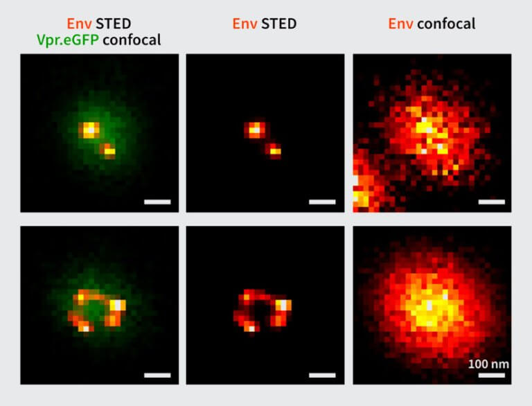 Stimulated Emission Depletion (STED) for virology